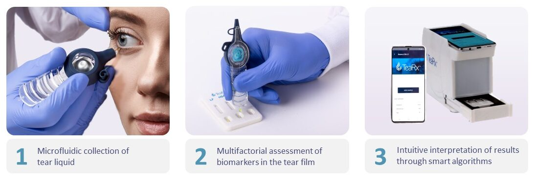 The TeaRx Platform - DiagnosTear